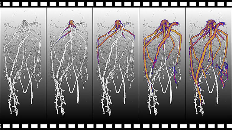 How plants use sugar flow to control microorganisms at their roots
