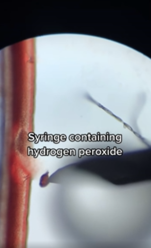 Why Peroxide & Tissues Are a Terrible Combo!