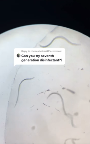 Microscopic World of Worms – Shocking Close-Up View!
