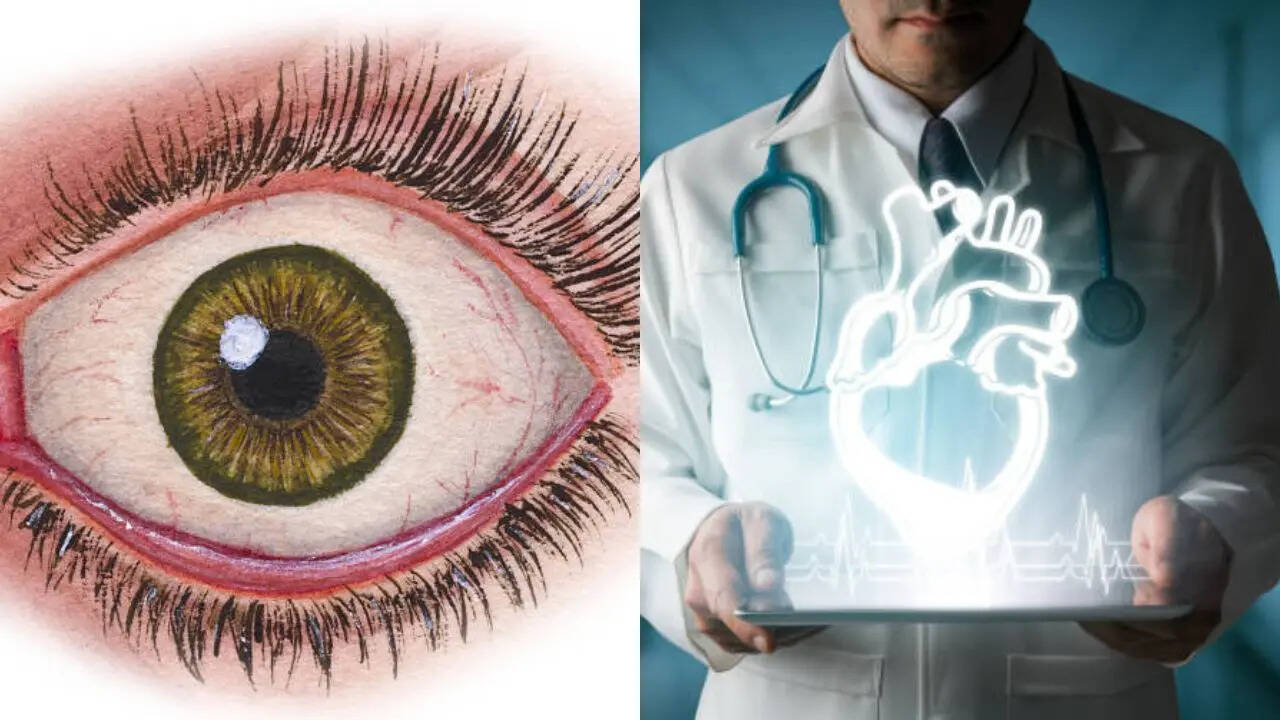 Can a Heart Attack Damage Your Vision? Crucial Link Revealed