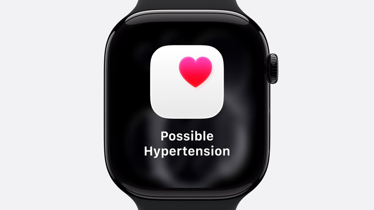 This new Apple Watch health feature is a game-changer — and it just got ...
