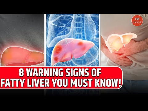 Fatty Liver Warning Signs You Must Not Ignore