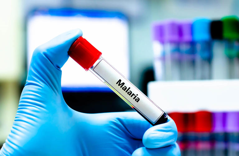 A new malaria case in New Jersey: Why doctor says there's no need to ...