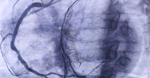 New Study May Reveal Why Some Patients Have Severe Reactions To MRI ...