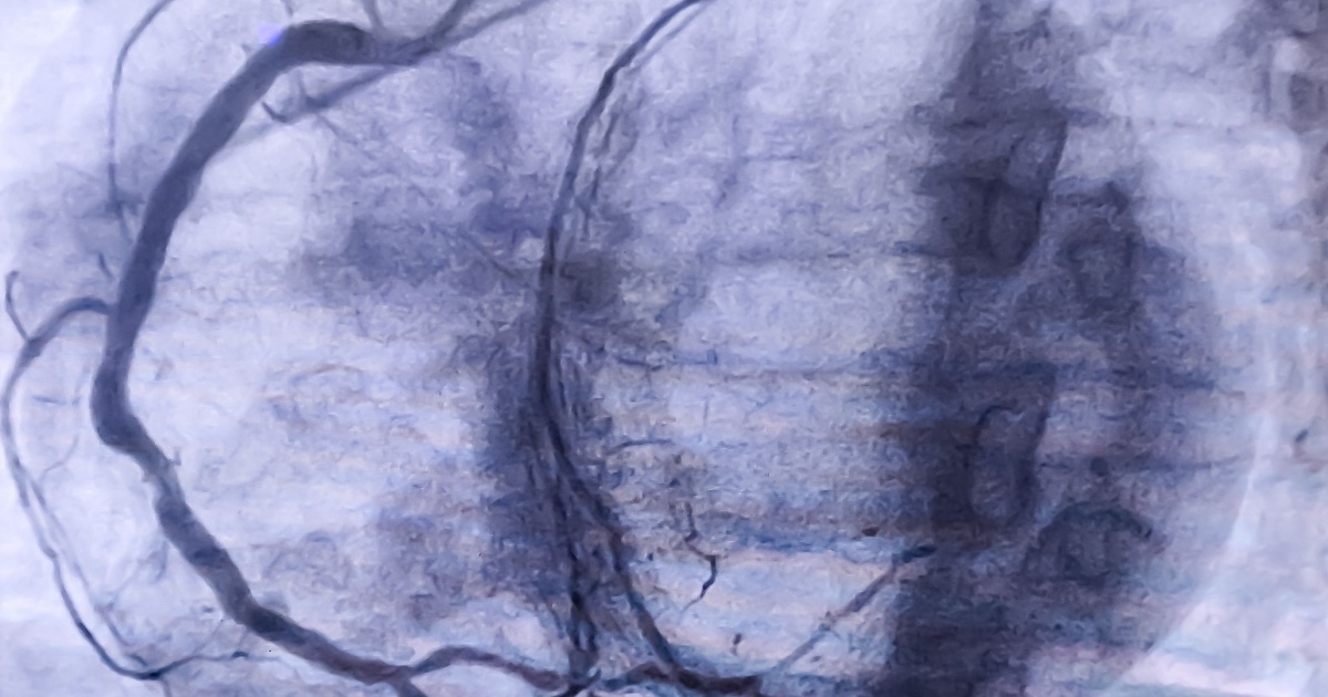 New Study May Reveal Why Some Patients Have Severe Reactions To MRI ...