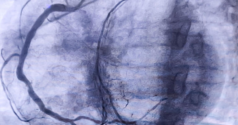 New Study May Reveal Why Some Patients Have Severe Reactions To MRI ...