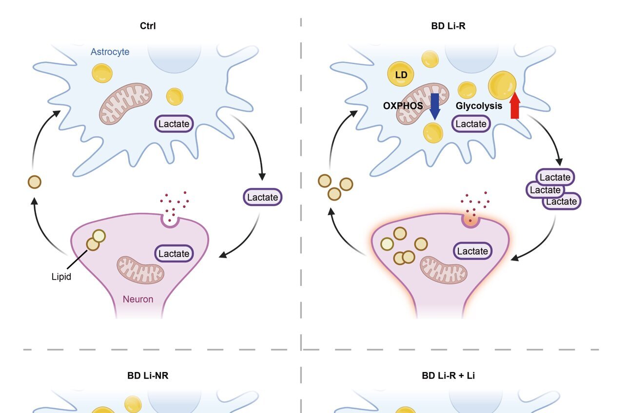 Star-shaped brain cells point the way to personalized bipolar disorder ...