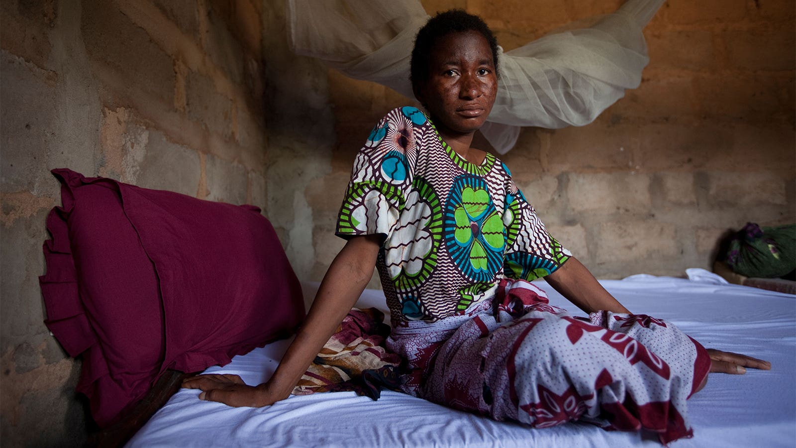 U.S. Aid Cuts Could Lead to 2.2 Million More TB Deaths, Study Estimates