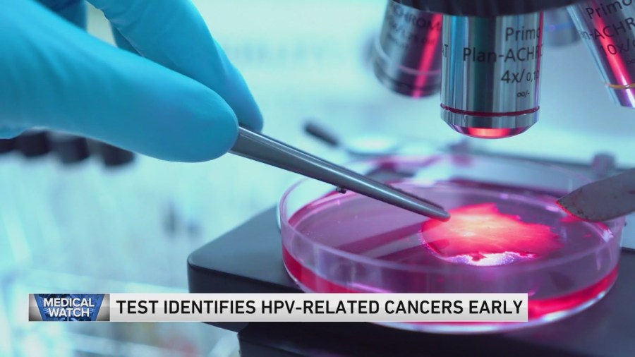 Test identifies HPV-related cancers early — and more health headlines