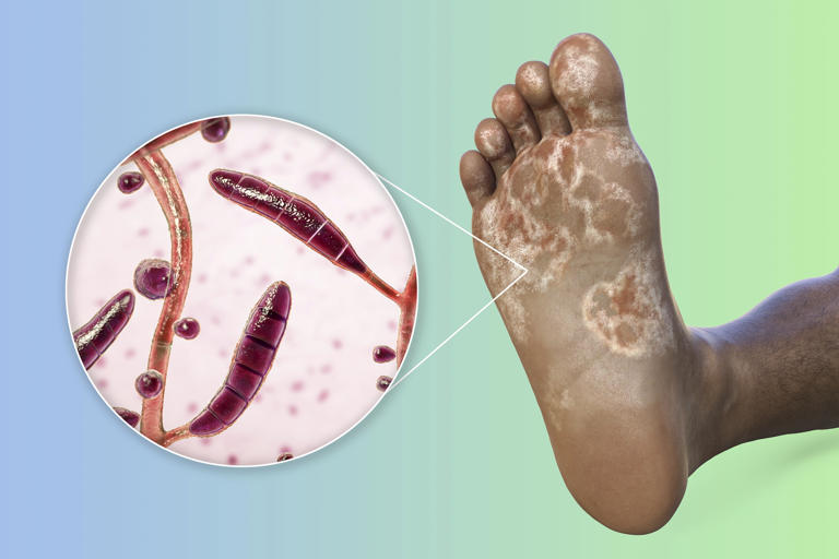 Trump paid El Salvador $5M to jail deportees – with conditions on ...