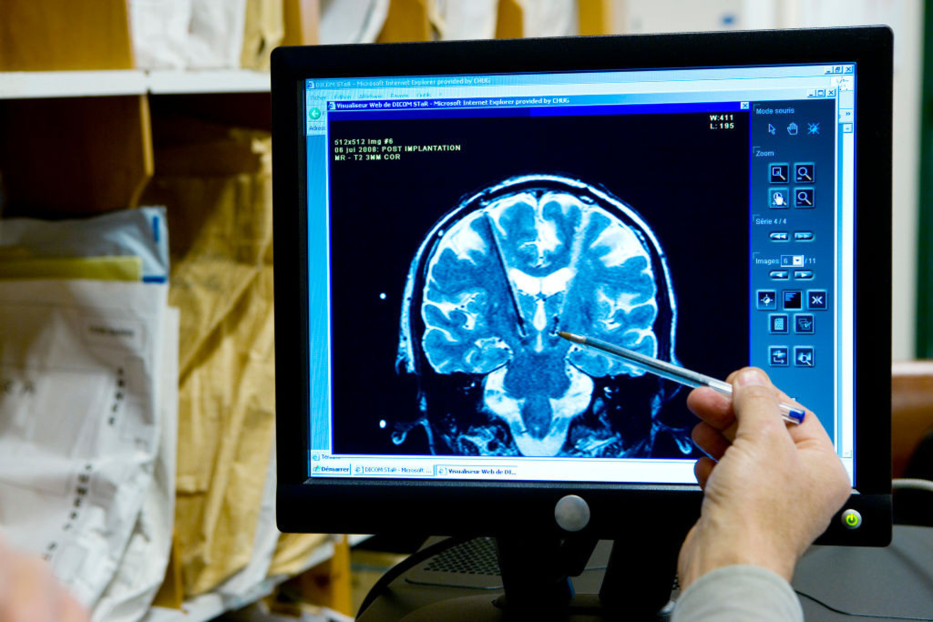Are you left-brained or right-brained?