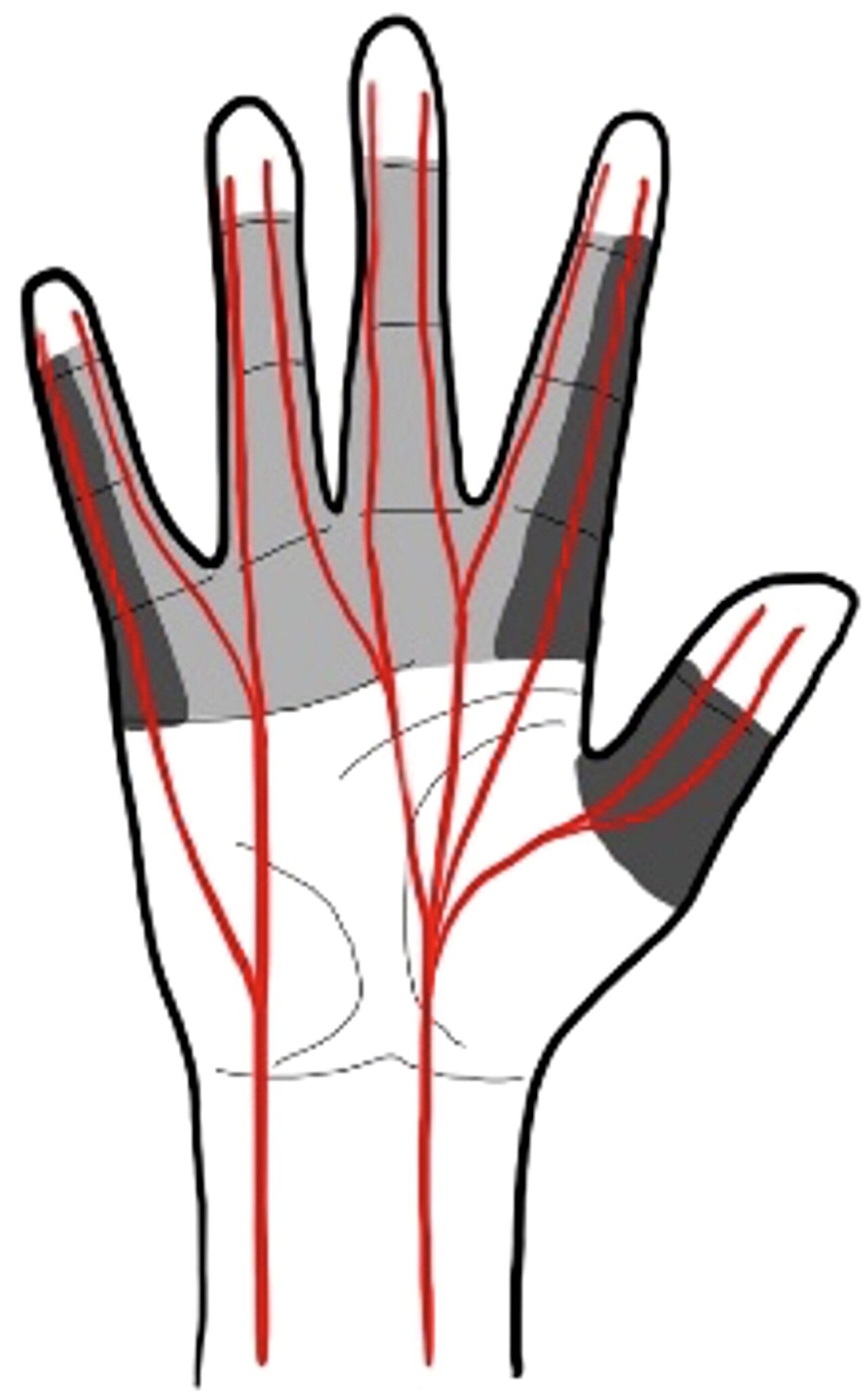 Trial shows that suture repair fails to improve digital nerve injury ...