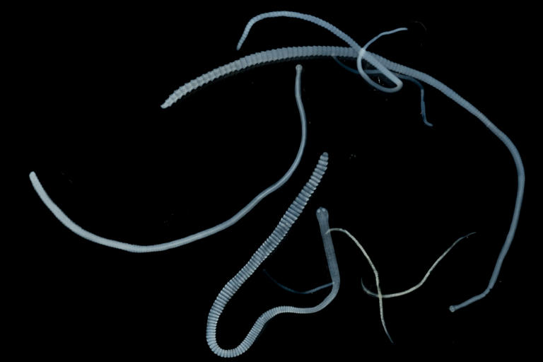 Pork Parasite Infects Man's Brain After Years of This Cooking Habit