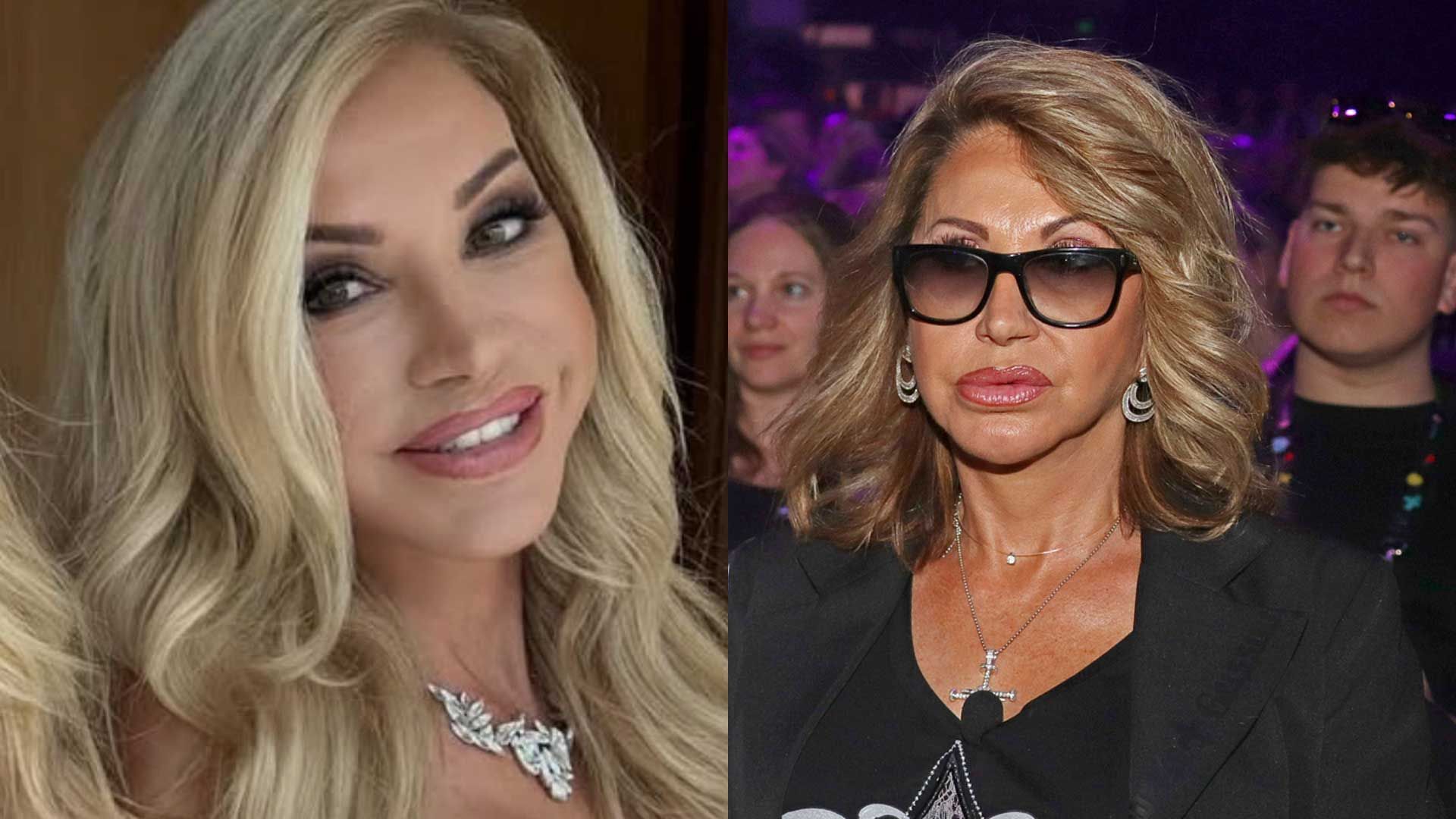 Nach Beauty-OP: Fans erkennen Carmen Geiss kaum wieder