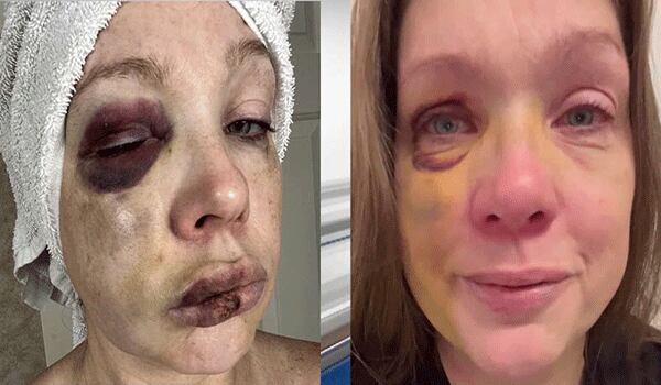 Cincinnati brawl: Suspect accused of punching, knocking out woman wants ...