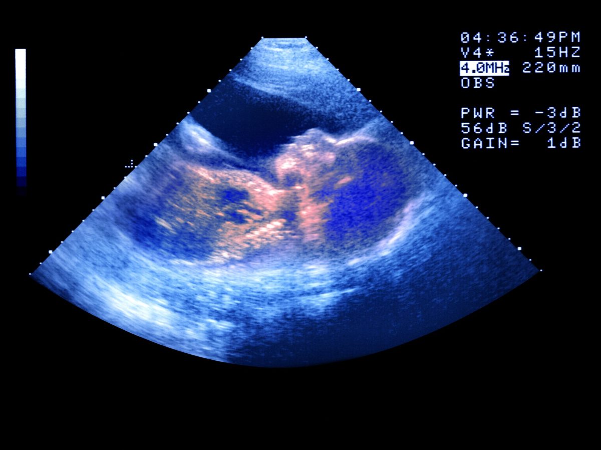 The first ‘designer babies’ are here – but can they really be more ...