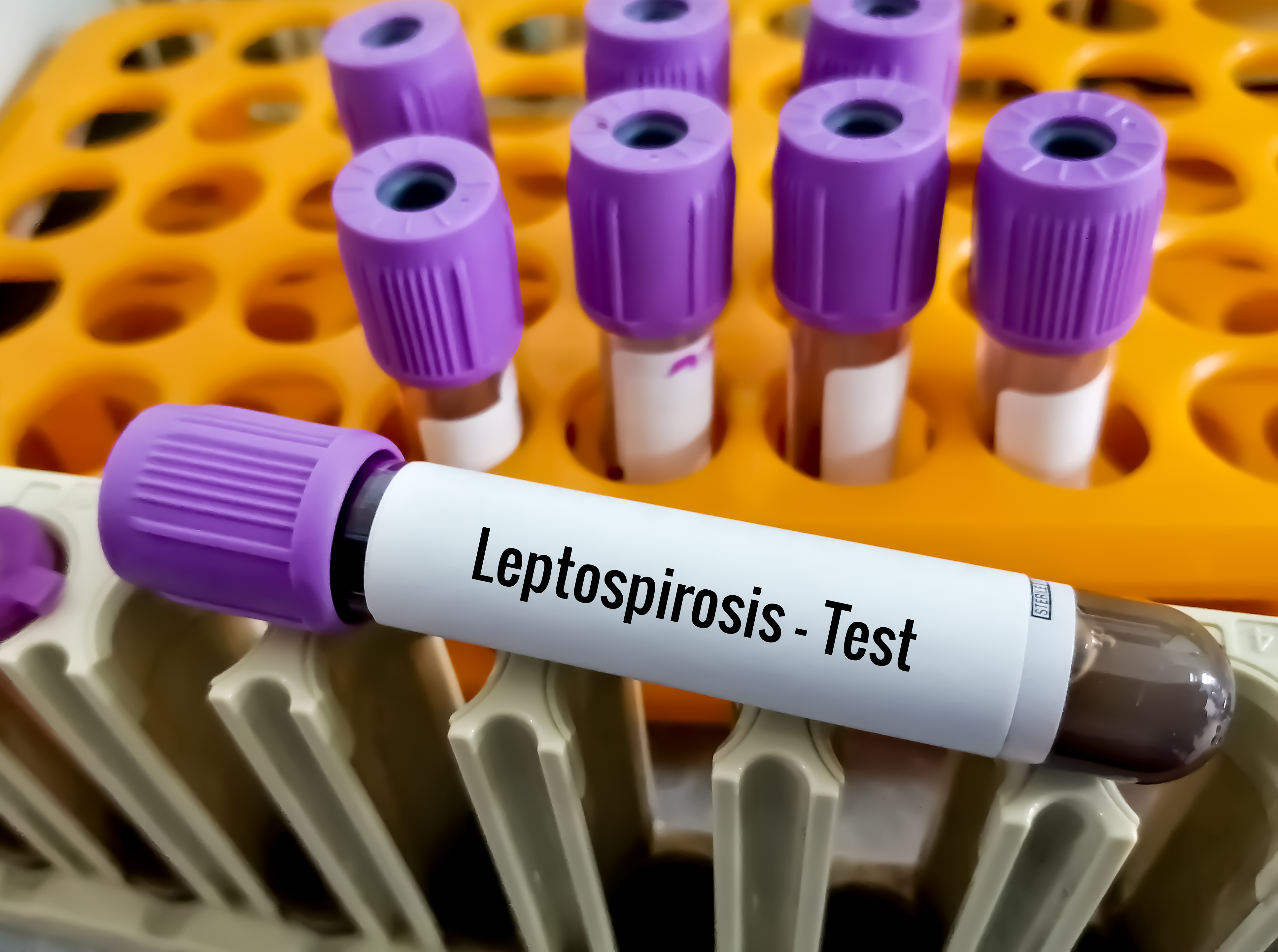 Death reported as Chicago issues health alert for leptospirosis
