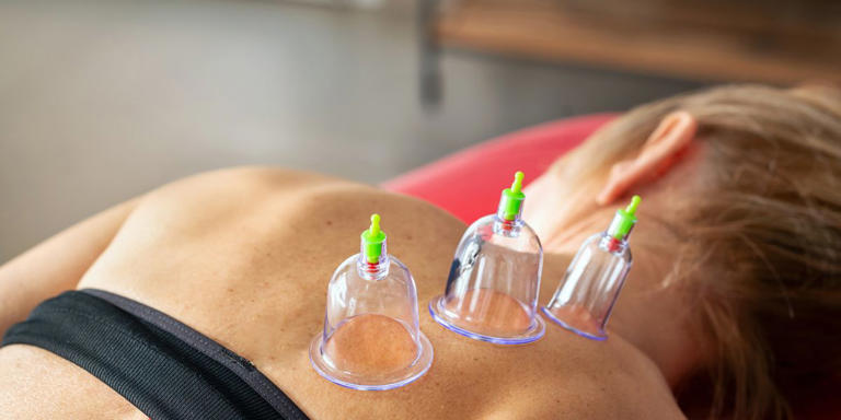 Can Cupping Really Fix Your Bike Ride Back Pain? My Surprising ...