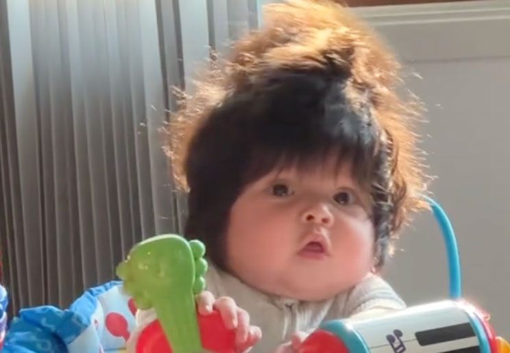 Five-month-old baby’s wild hair has him compared to a Cabbage Patch ...