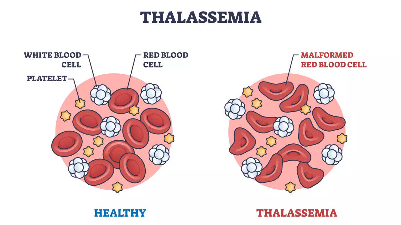 What is Alpha Thalassemia? How is it diagnosed?