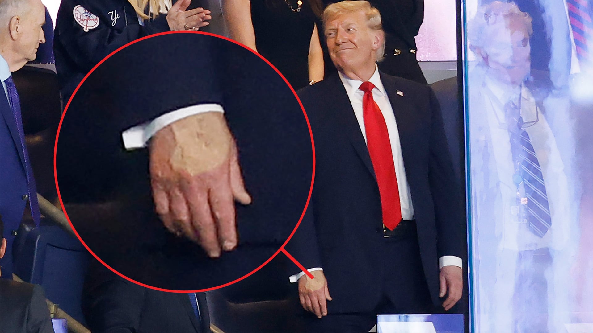 Trump, 79, Cakes Hand in Makeup for Yankees Game