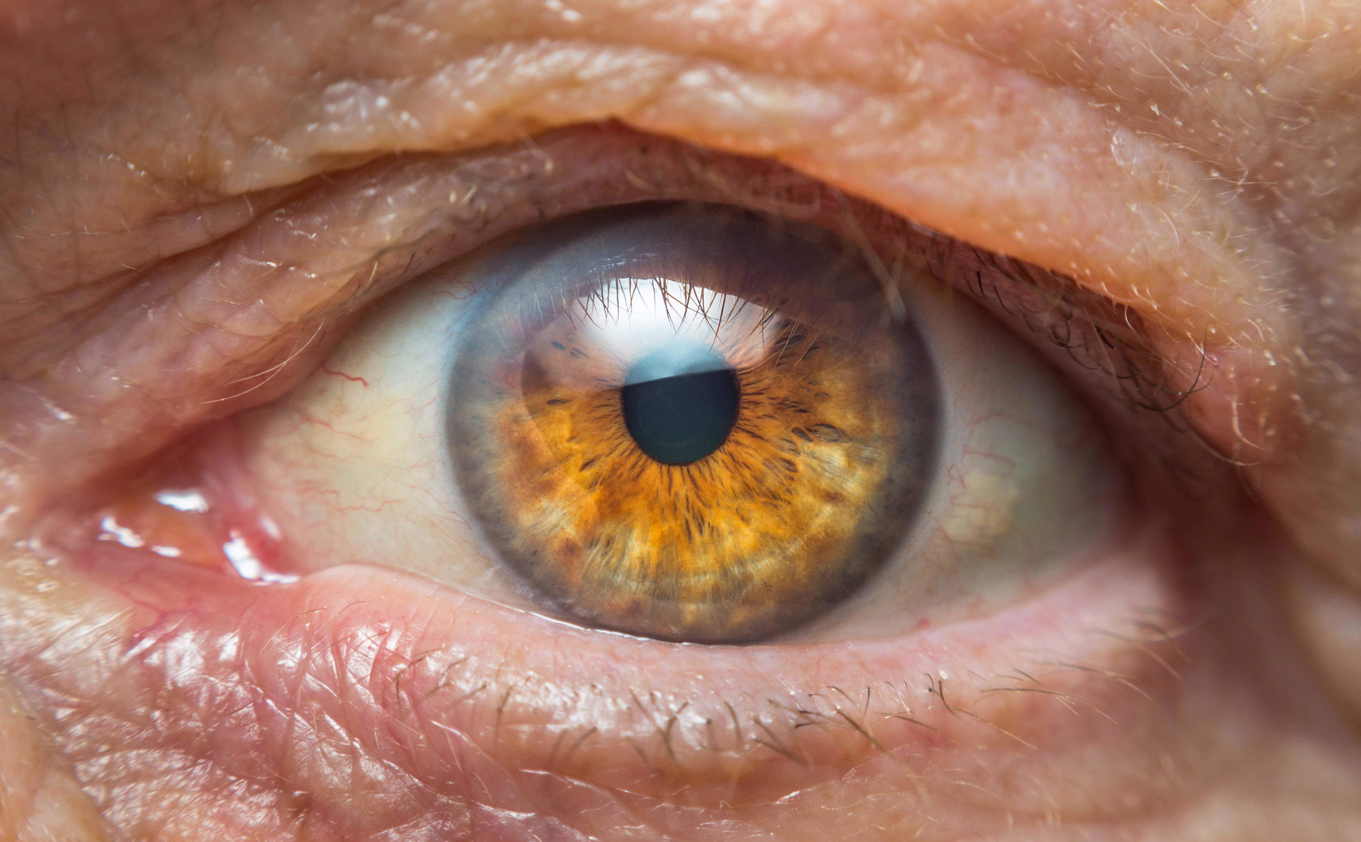 Double cataract surgery is better for patients, studies suggest