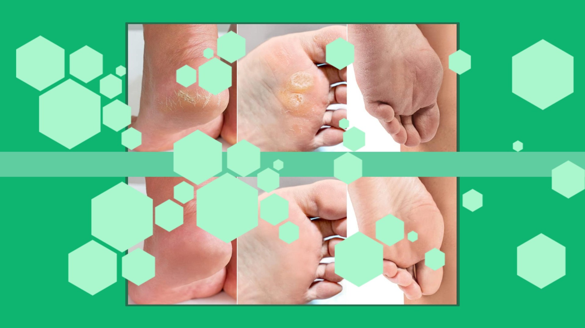 Say goodbye to dry feet with Plantifique Foot Mask