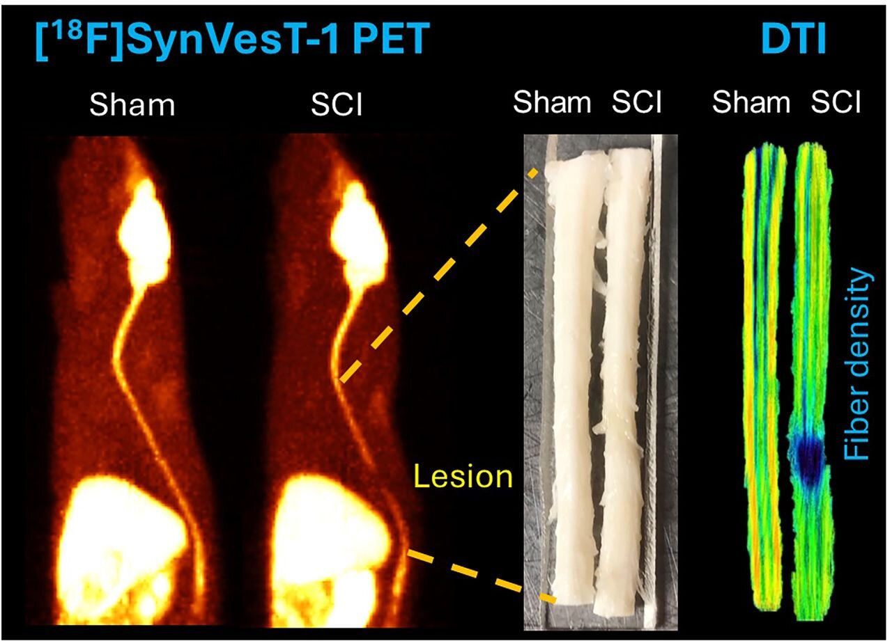 Novel PET tracer detects synaptic changes in spinal cord and brain ...