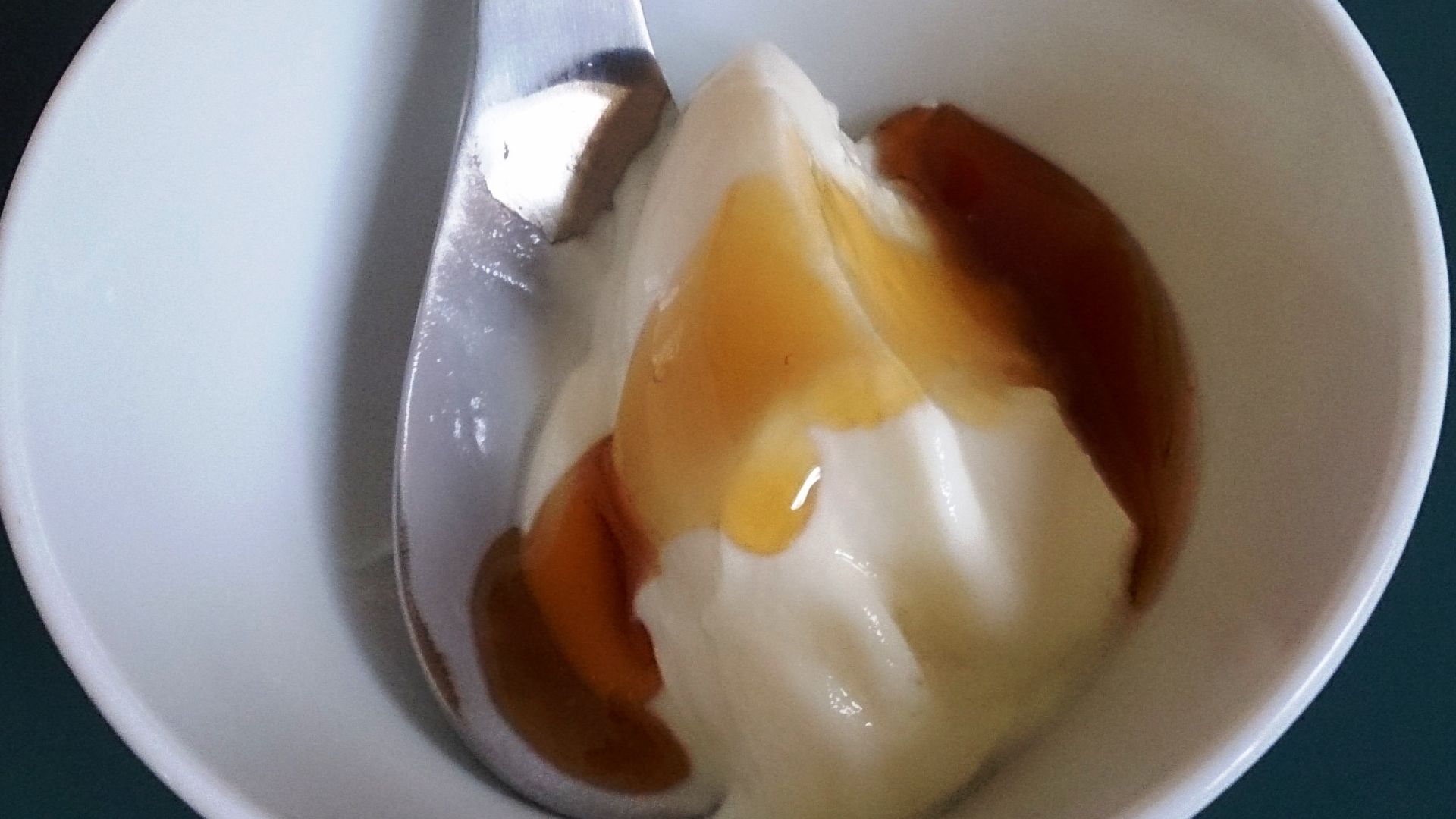 10 Best Foods To Eat After Dental Surgery & 10 To Completely Avoid