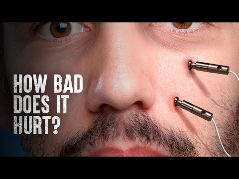What happens during a Taser attack and how people survive