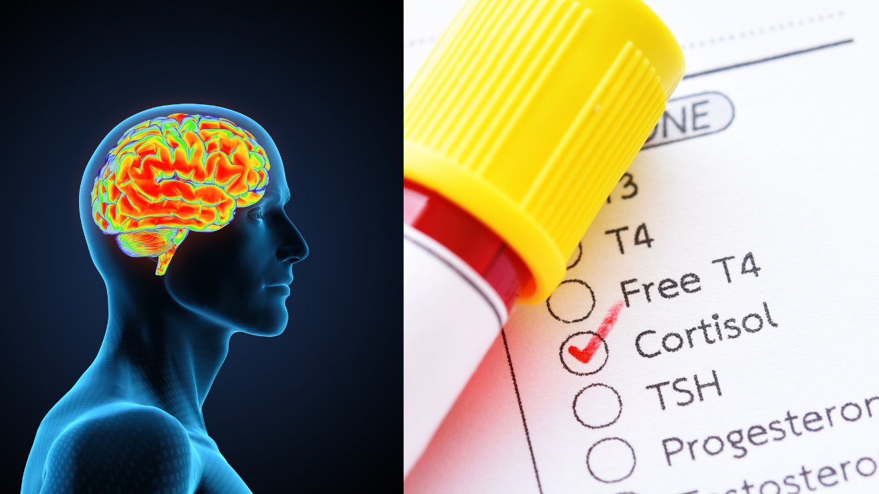 Always stressed? High cortisol is quietly 'killing' brain cells, and ...