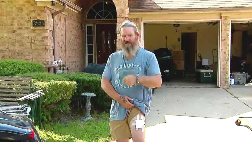 Grand Prairie man details being shot by police after 911 error sent them to wrong home