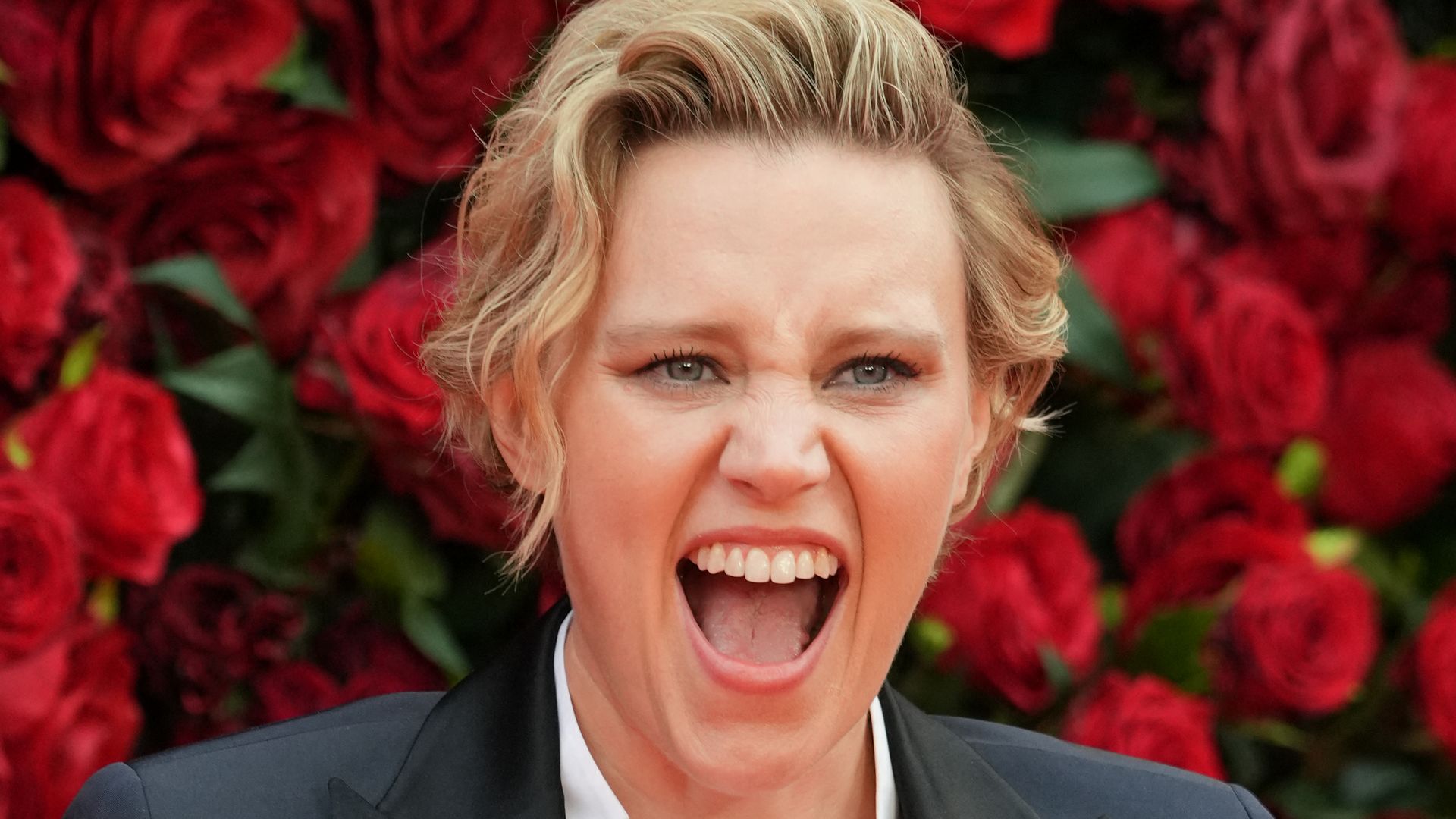 What is geographic tongue? SNL's Kate McKinnon reveals her 'gross ...
