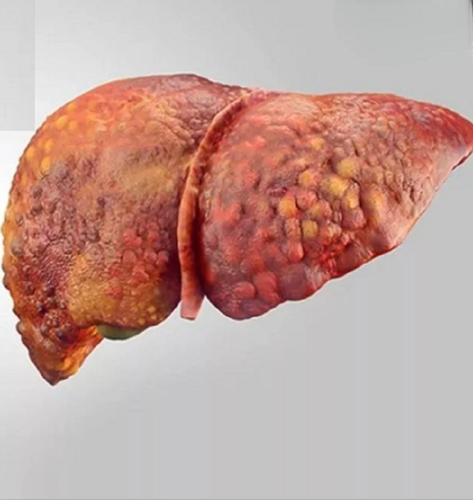 If you see these 3 symptoms at night, then understand that the liver ...