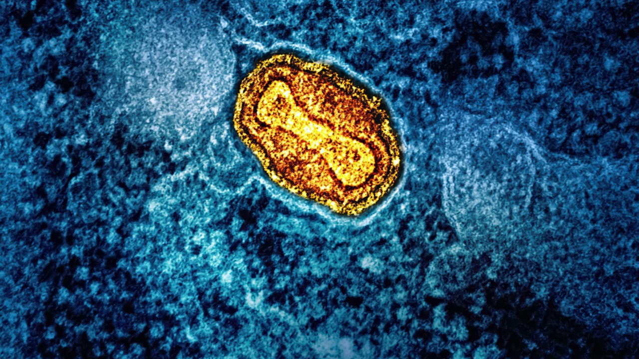 Ancient virus revived from Siberian ice sparks biosecurity debates