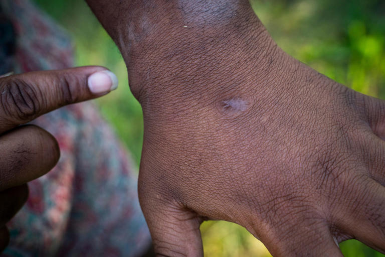 Stopped for a curfew violation, shot by police: When nonviolent stops ...