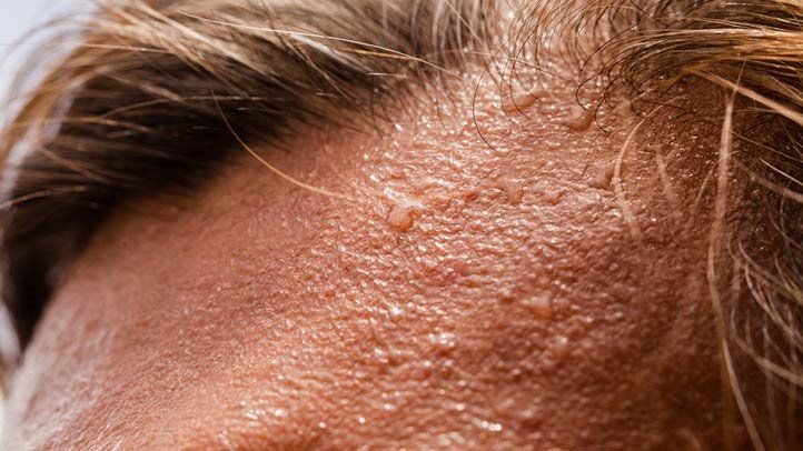 10 Myths About Excessive Sweating, Debunked