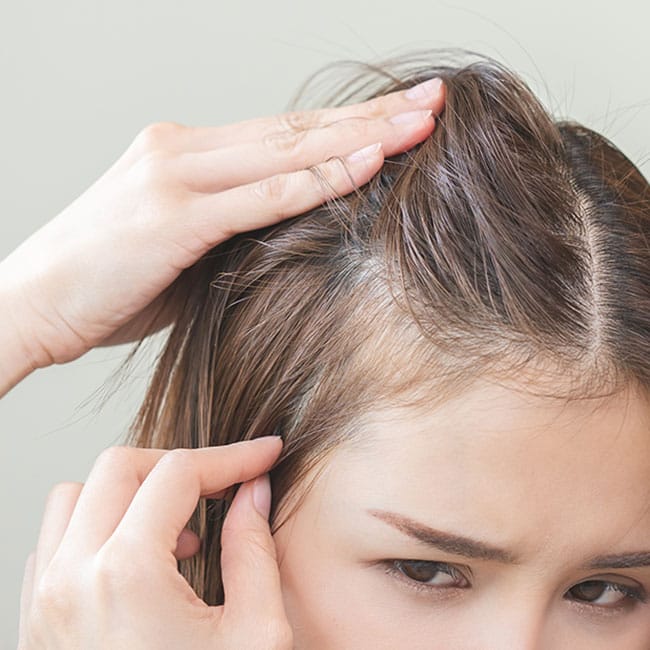 6 Common Hair Care Ingredients Linked To Hair Loss And Scalp Irritation