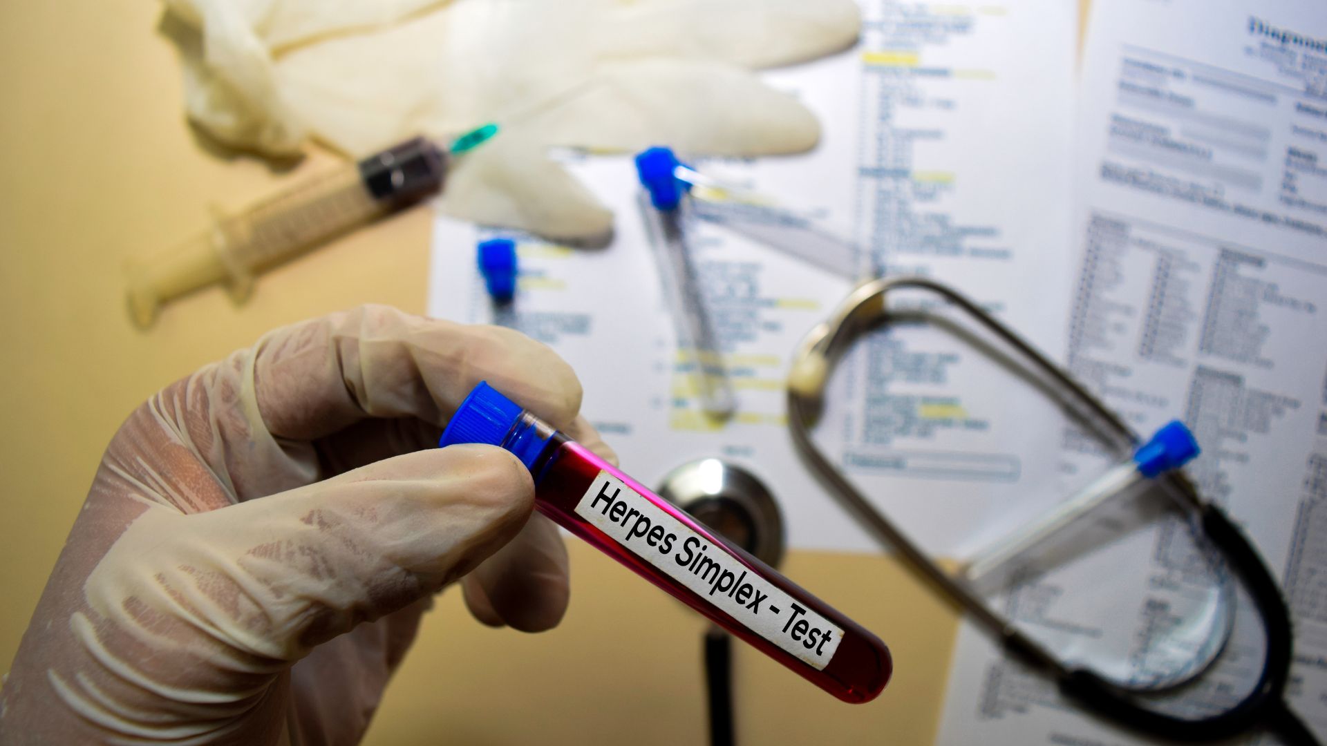 Common Childhood Virus Could Be Fueling Alzheimer’s In Old Age