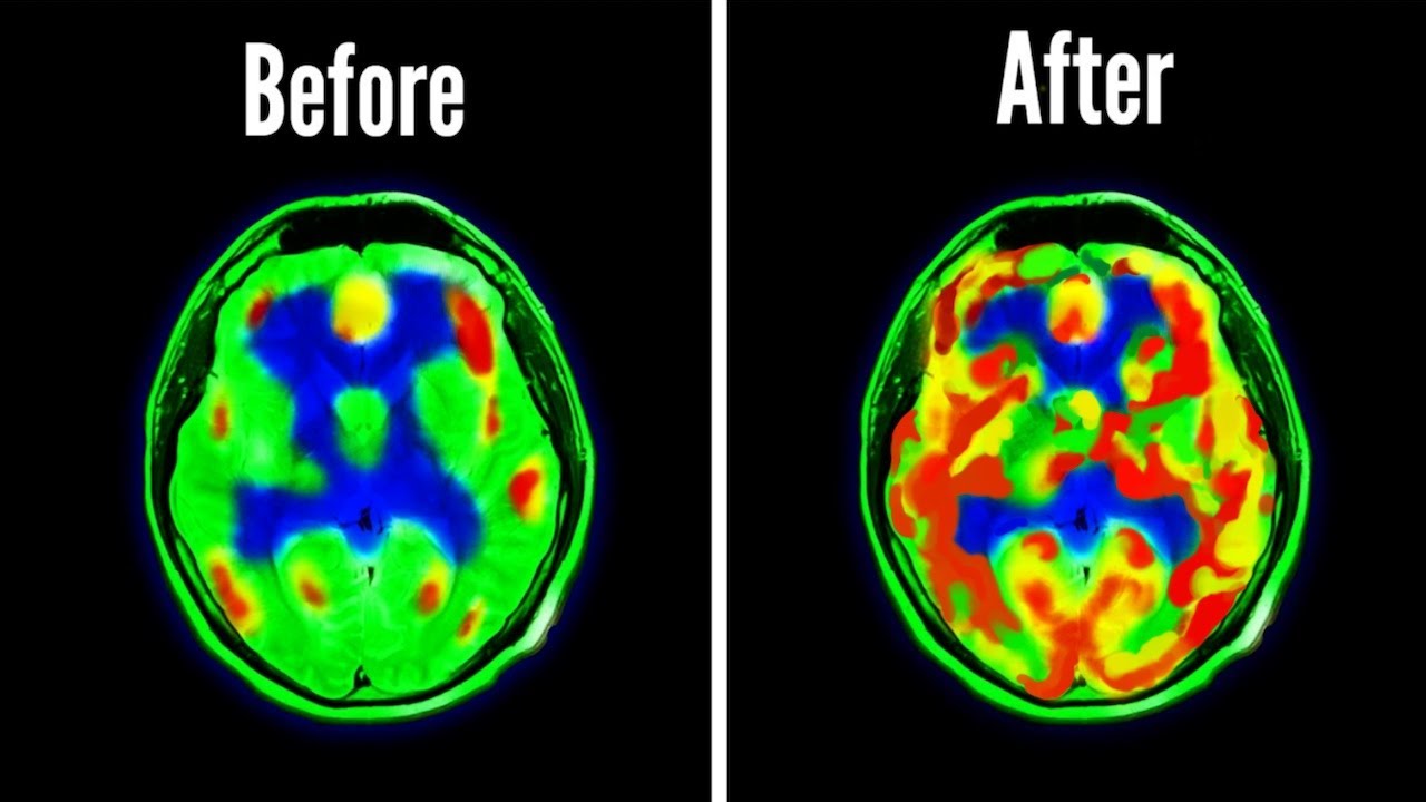How dopamine detoxing changed my brain