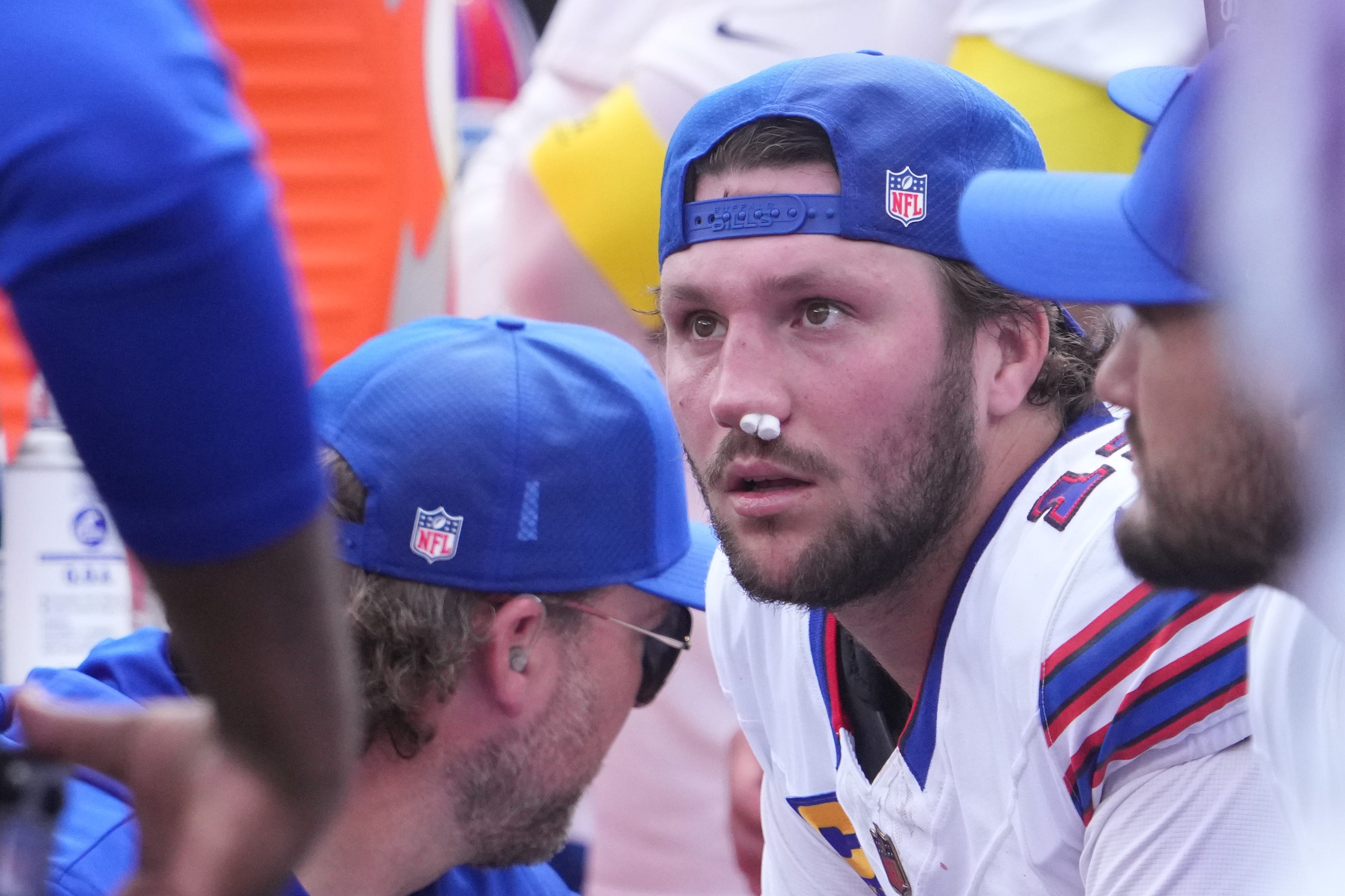 Josh Allen injury: Bills quarterback leaves game with nose gushing blood