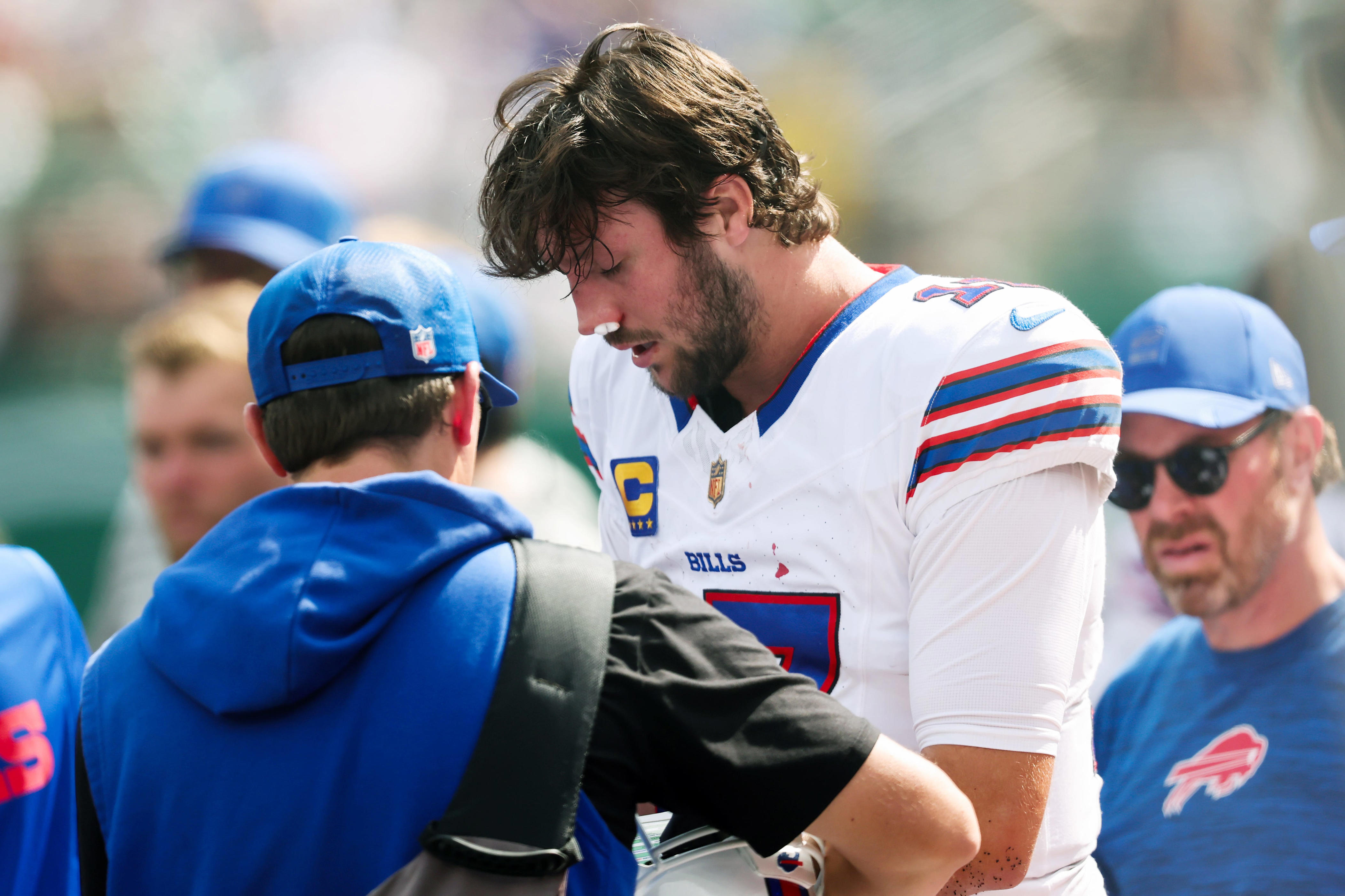 Josh Allen injury: Bills quarterback leaves game with nose gushing blood