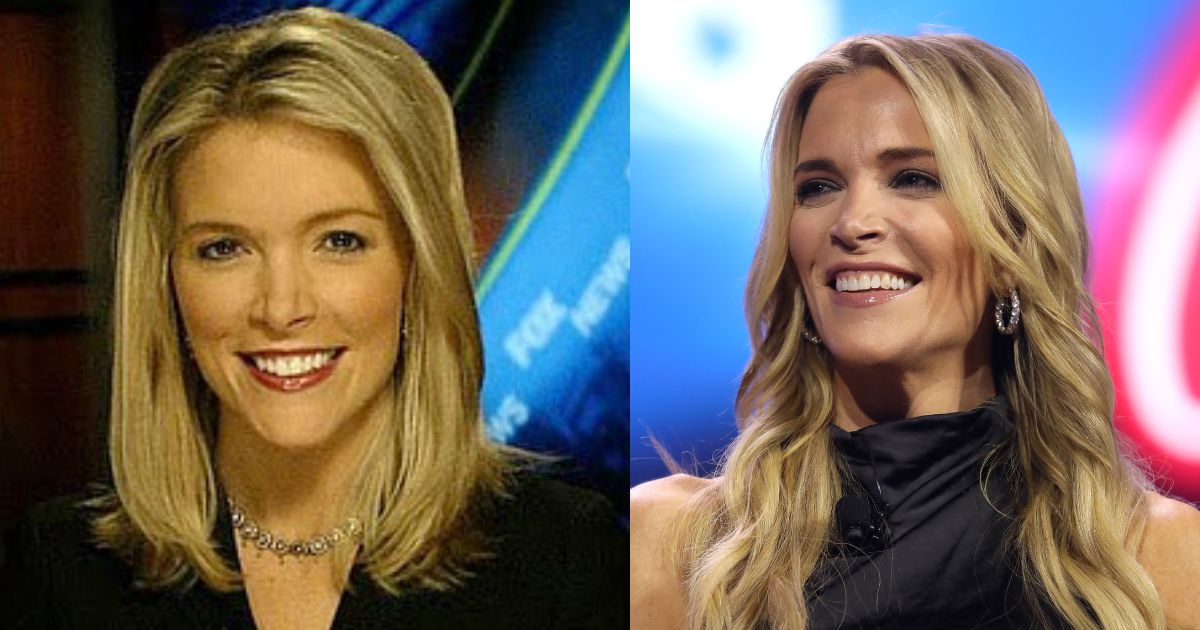 Megyn Kelly’s Plastic Surgery Rumors Just Got Worse – Expert Says Her ...