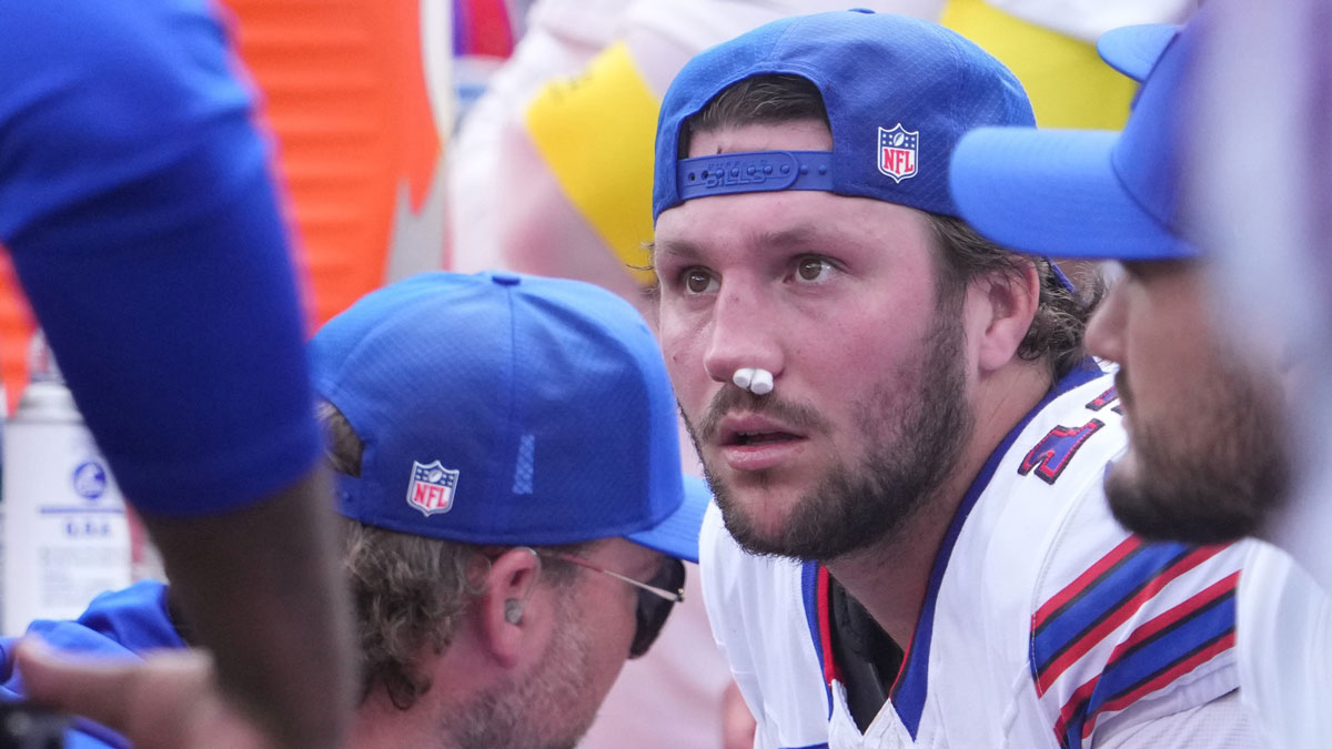 Bills’ Josh Allen ‘can breathe’ despite nasty-looking nose injury