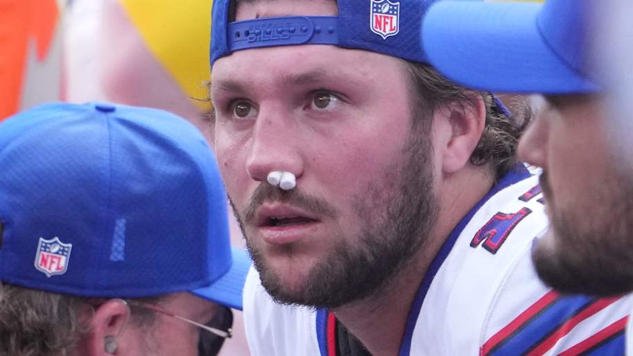 Josh Allen's bloody nose injury 'still kind of going on me' after Bills ...