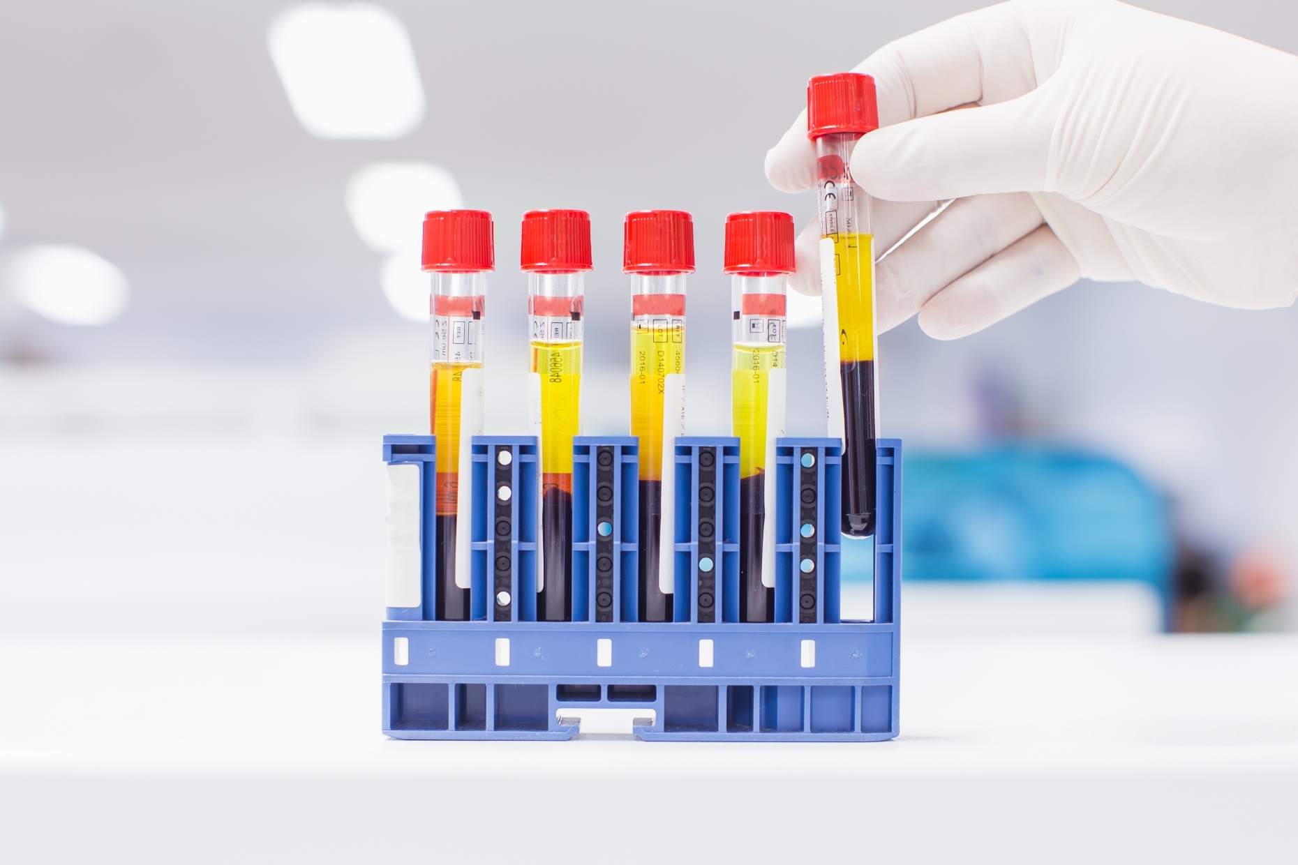 20 things to know about blood