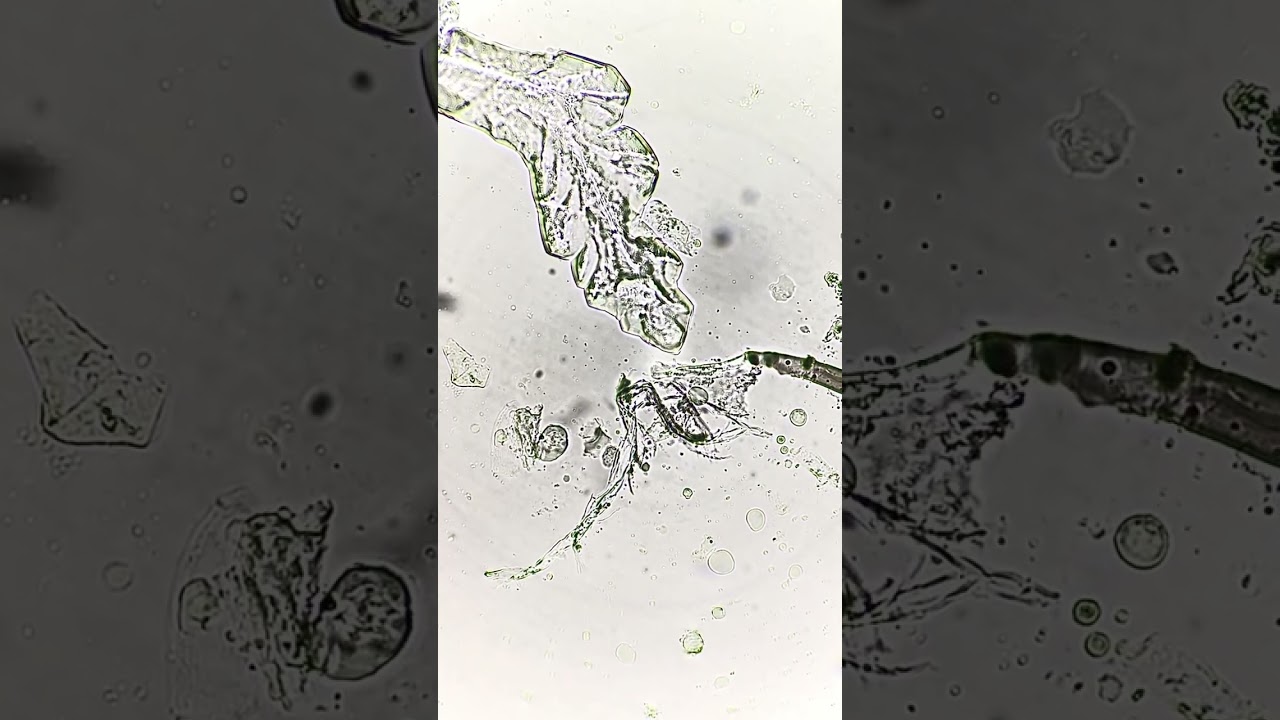 Bro Looks At A Drop Of Sweat Under A Microscope! Crazy Find!