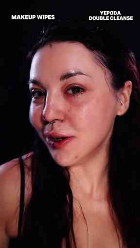 Your Skin Deserves a Clean Slate