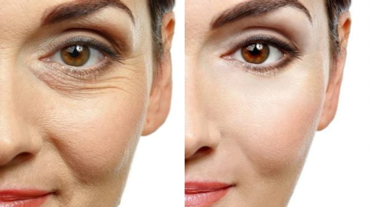 Skincare Guide: Simple DIY Remedies to Prevent Early Facial Wrinkles