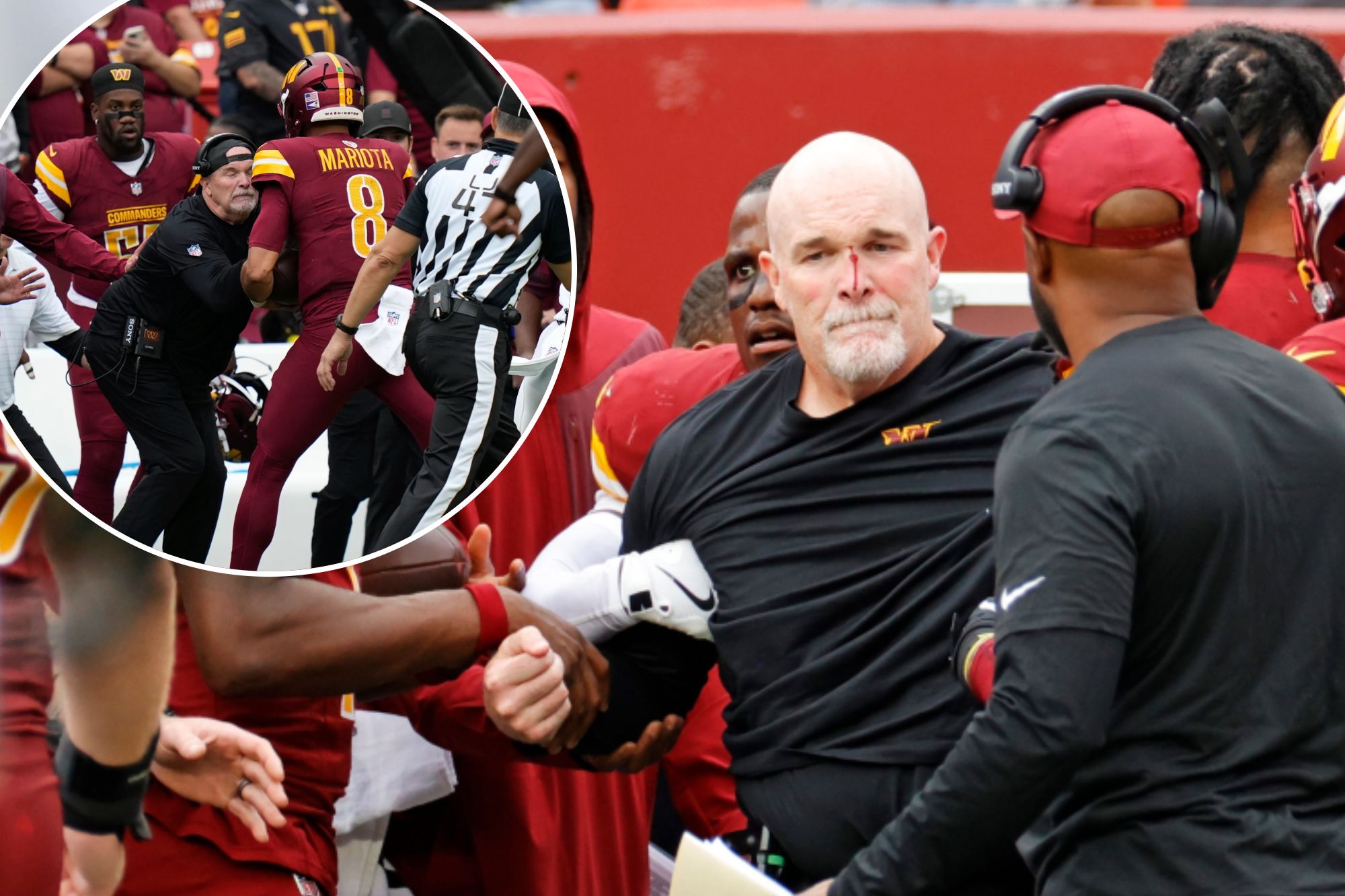 Commanders coach Dan Quinn bloodied after head-on collision with Marcus ...